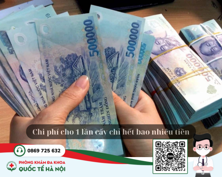 Chi phí cho 1 lần cấy chỉ bao nhiêu tiền - Bảng giá mới